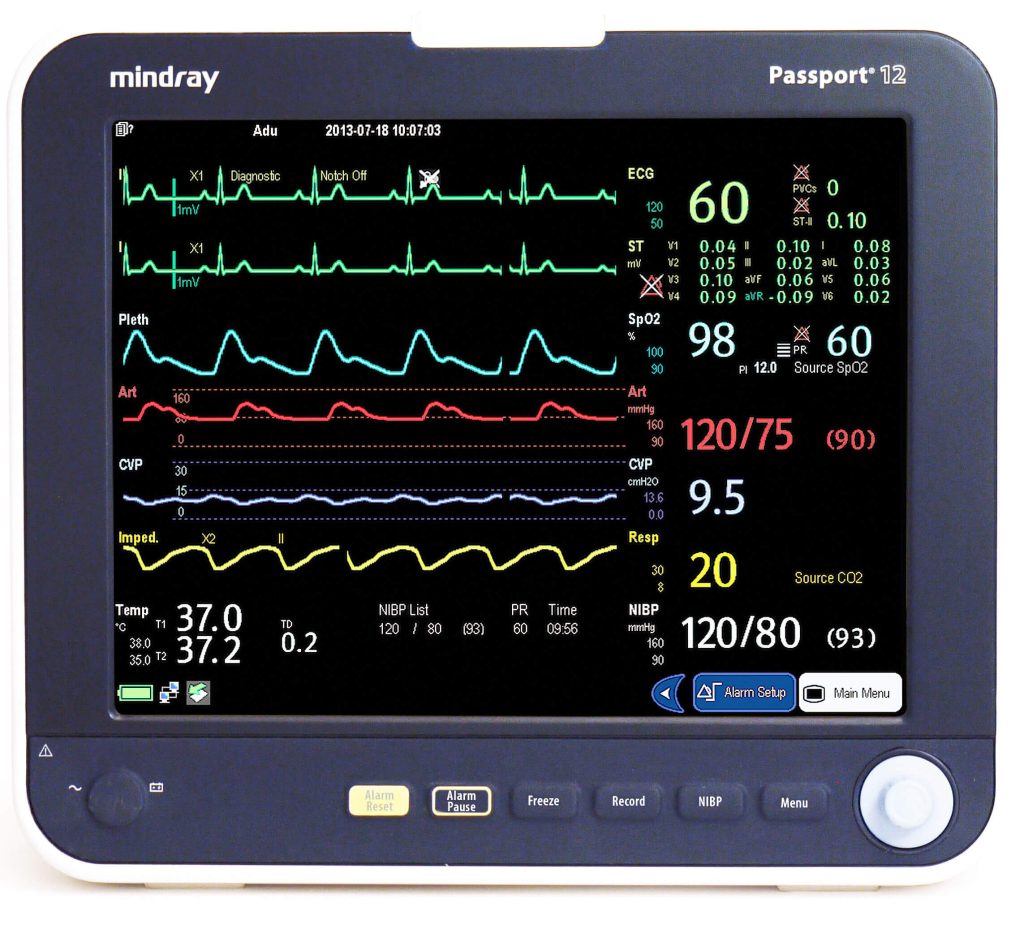Mindray Passport 12 with Multigas O2, IBP, Cardiac Output | Auxo Medical
