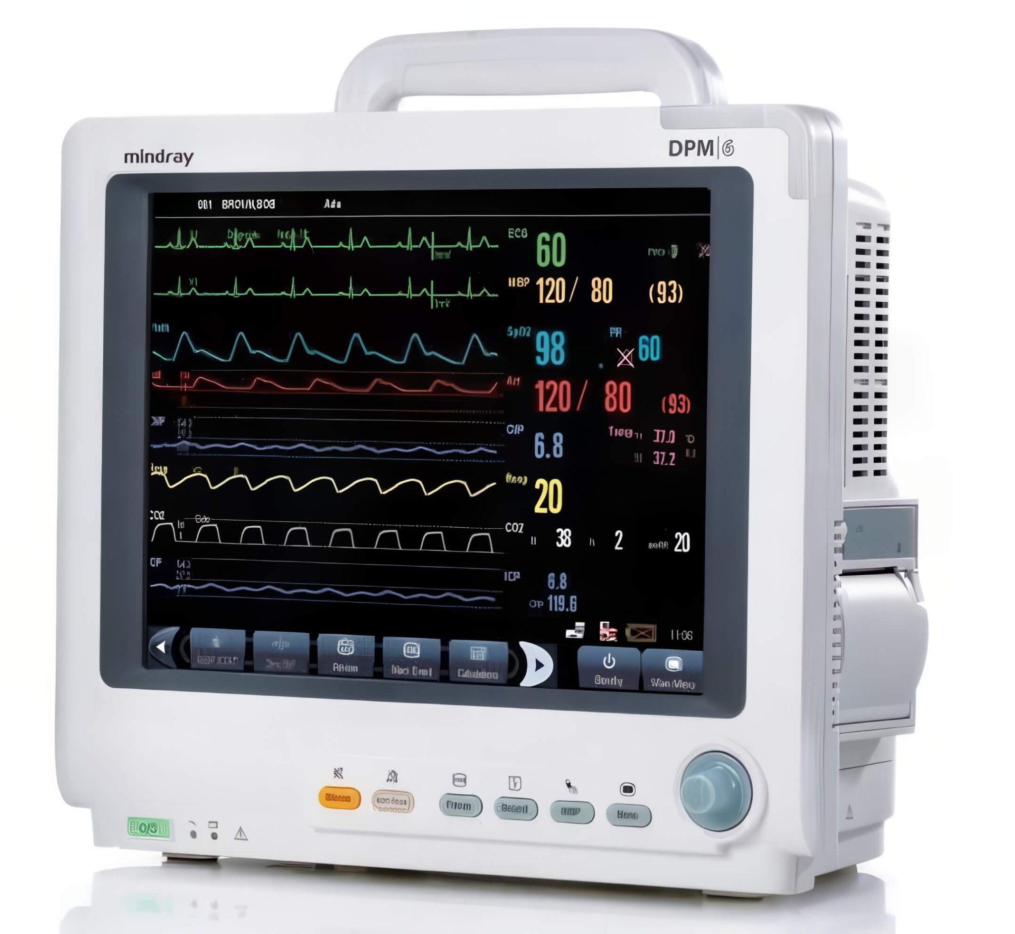 Mindray DPM6 PACU Monitor w/ 12 lead Masimo MPM | Auxo Medical