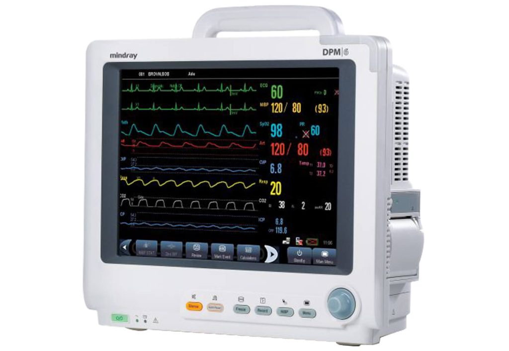 Tracking the Depths: Anesthesia Monitor's Vital Role | Auxo Medical