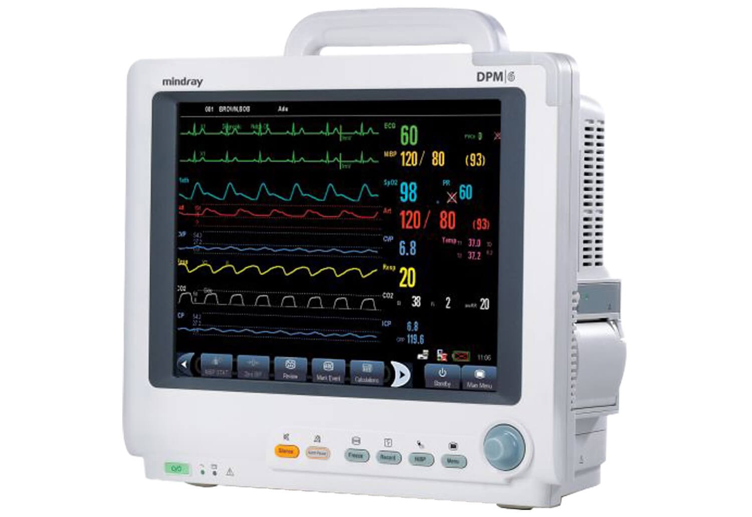 Tracking the Depths: Anesthesia Monitor’s Vital Role | Auxo Medical