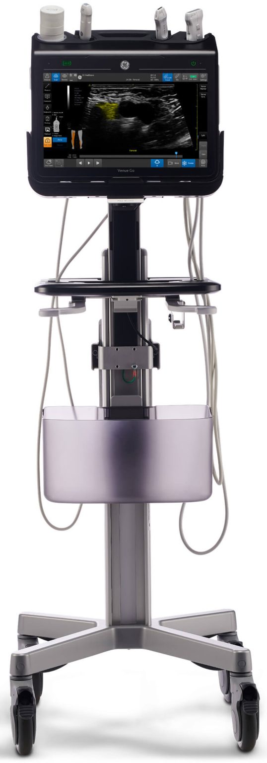 GE Venue GO Ultrasound with 2 probes and Cart | Auxo Medical