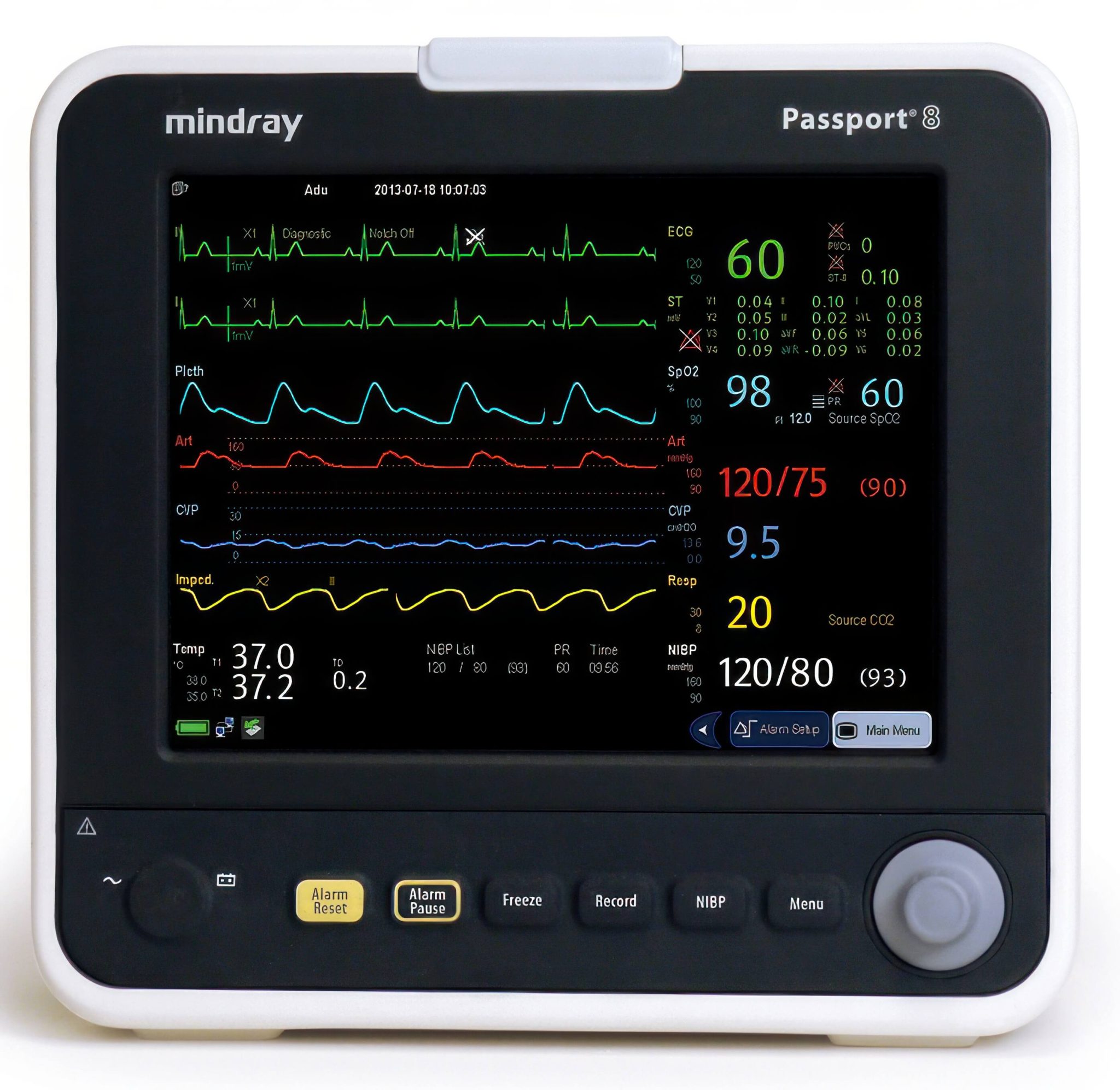Mindray Passport 8 | Products - Patient Monitors | Auxo Medical