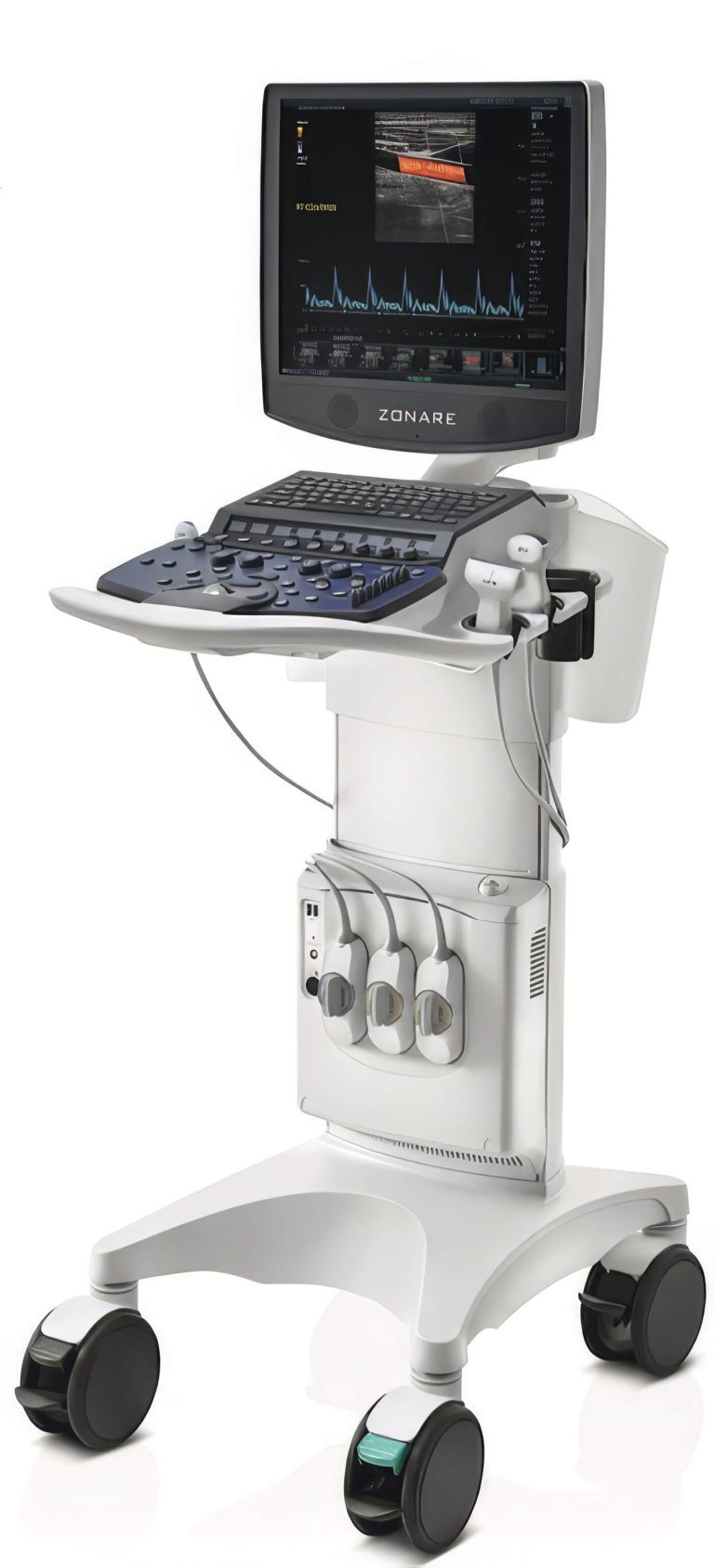 Mindray Zonare S3 Ultrasound | Auxo Medical