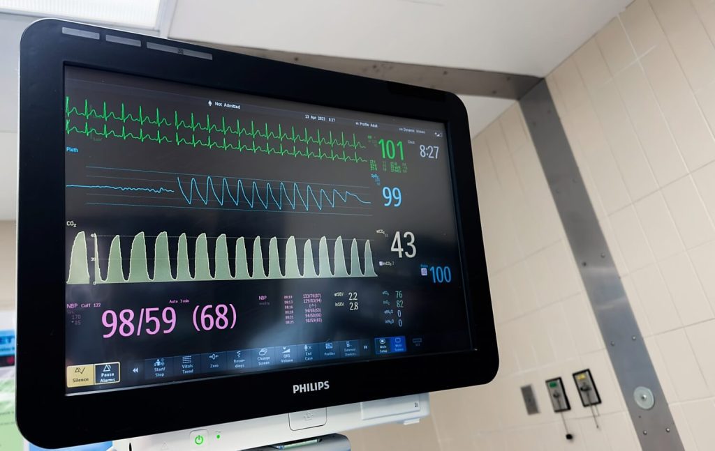 Patient Monitors Available at Auxo Medical | Auxo Medical