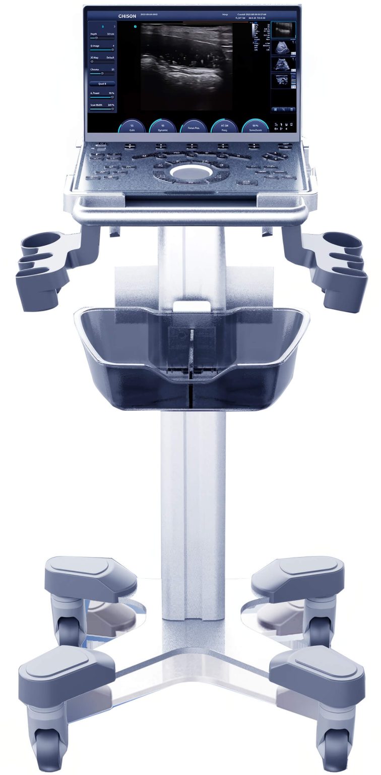 Mindray TE5 Ultrasound (with 2 Probes) | Auxo Medical