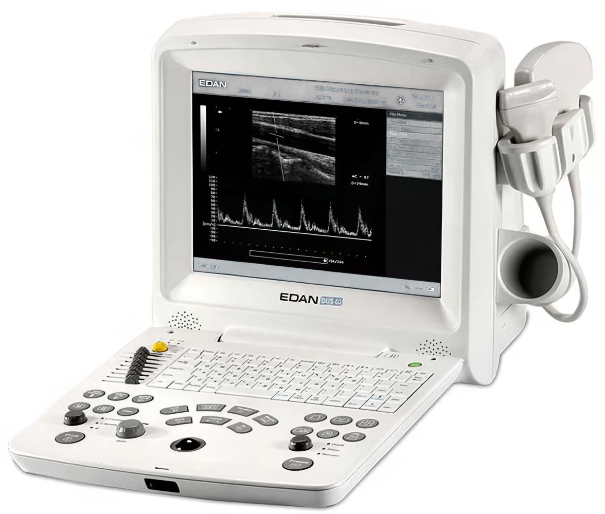 Siemens ACUSON Sequoia Ultrasound System | Auxo Medical