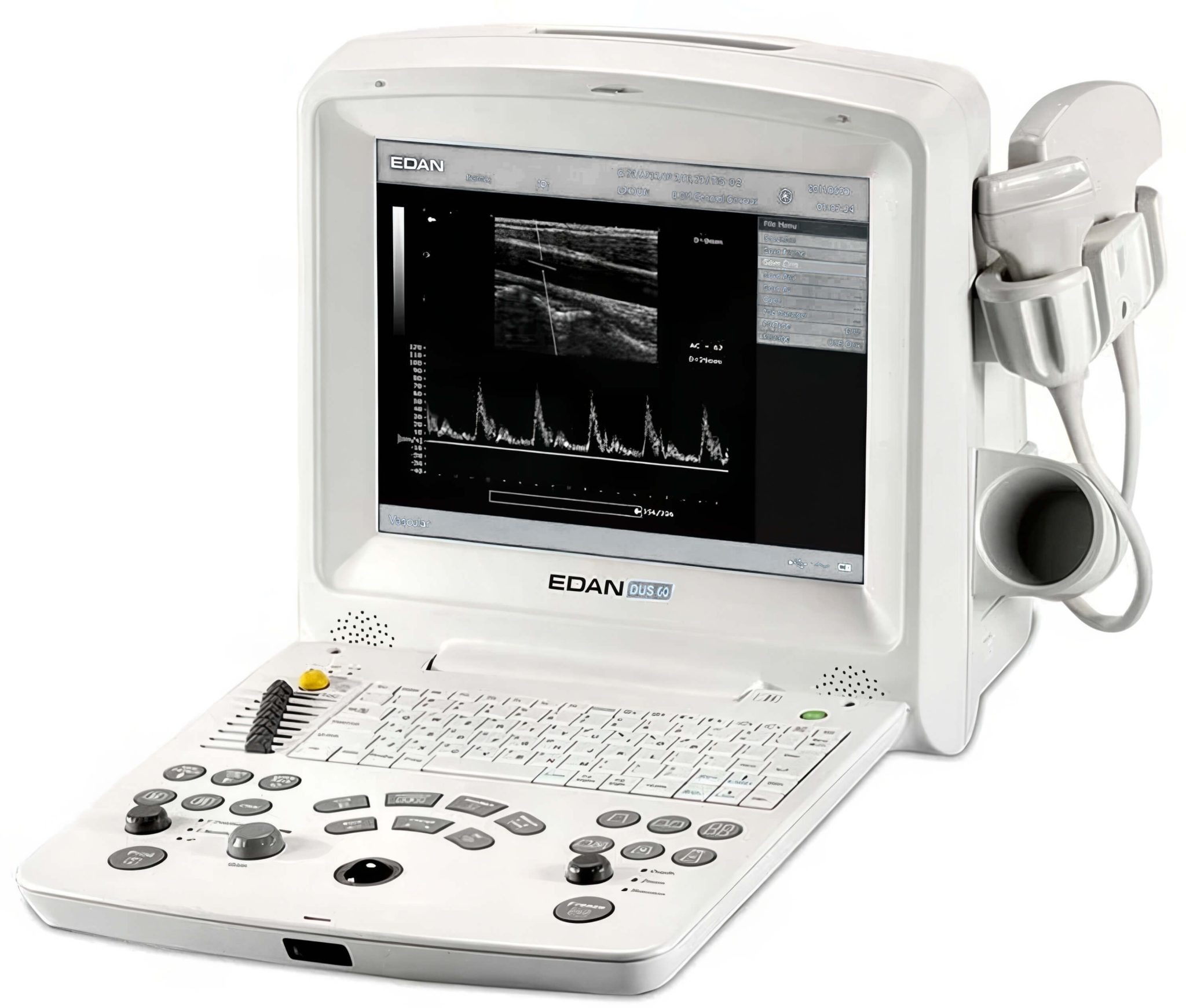 Ultrasound Machines | Auxo Medical | Medical Equipment