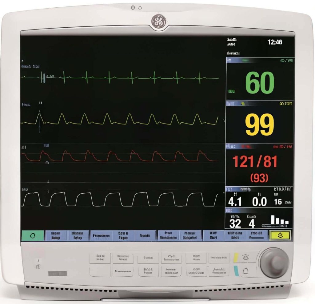 GE DINAMAP Carescape V100 Vital Signs Monitor | Auxo Medical