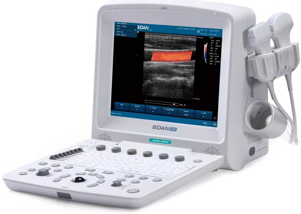 Siemens ACUSON Sequoia Ultrasound System | Auxo Medical